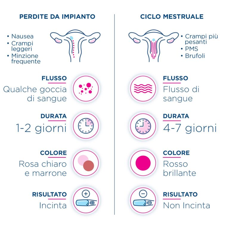 Le perdite da impianto - FioccoRosa